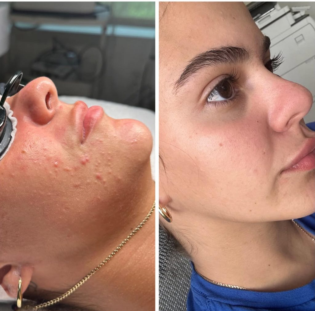 Meet Indira Ramirez | Skin Specialist Aesthetician - SHOUTOUT MIAMI